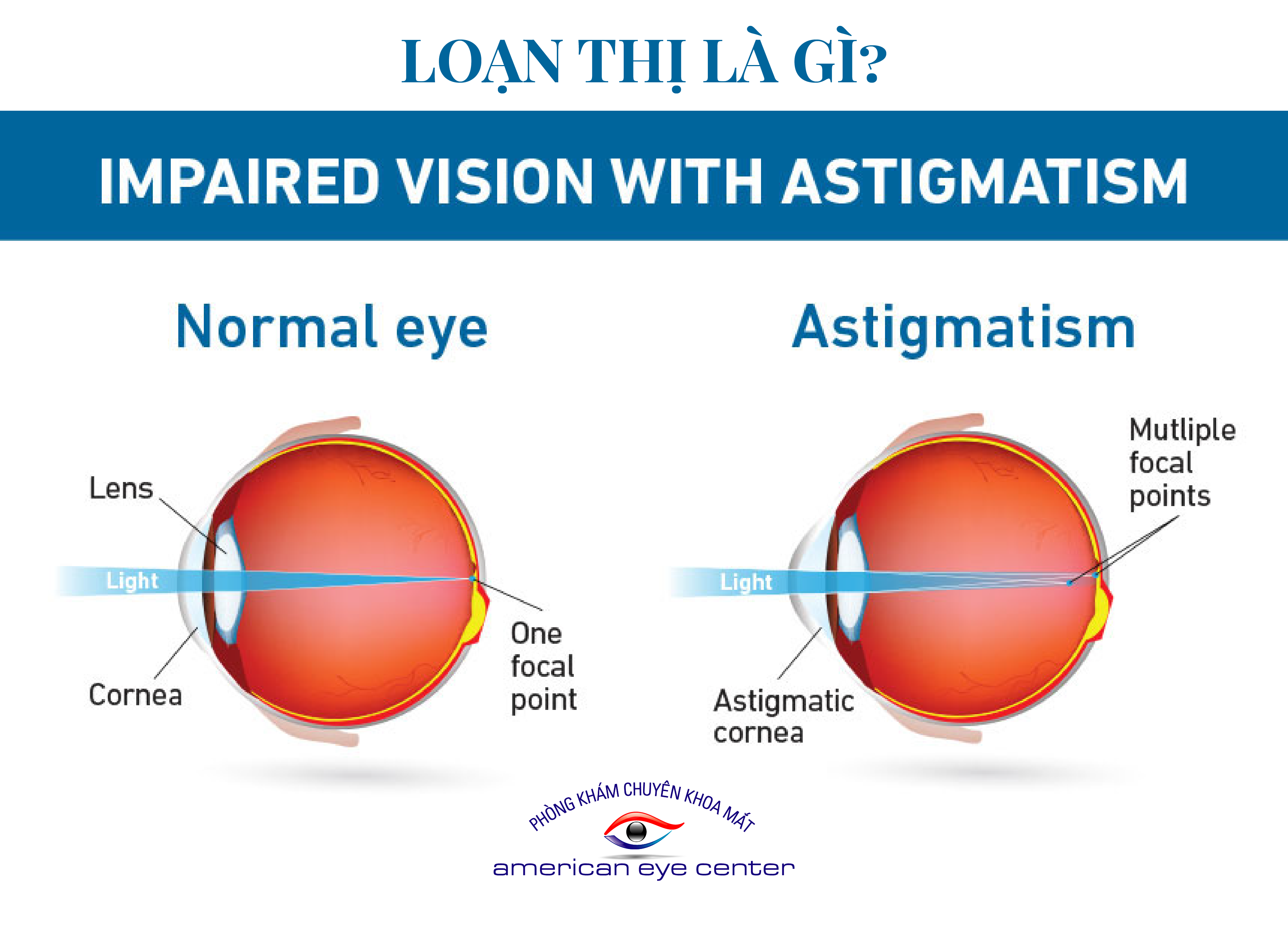 Noob là gì? Cách sử dụng và ví dụ câu dễ hiểu cho người học tiếng Anh